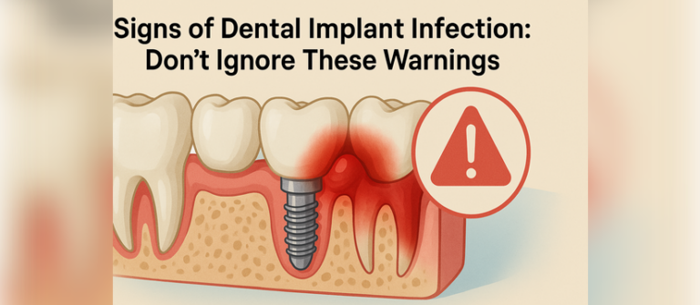 Dental Implant Infection Signs: Don't Ignore These Warnings