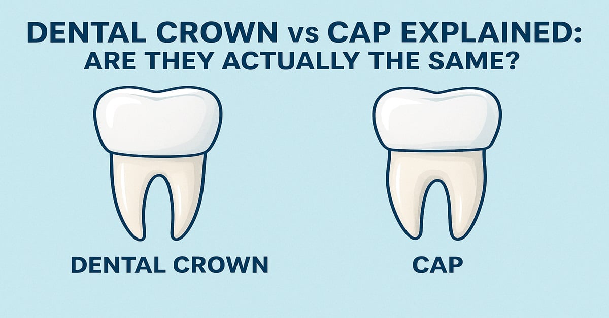 Dental Crown vs Cap: Are They Actually the Same?